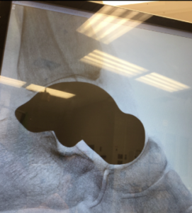 Avascular Necrosis of the Foot & Ankle - Apex Foot & Ankle Institute